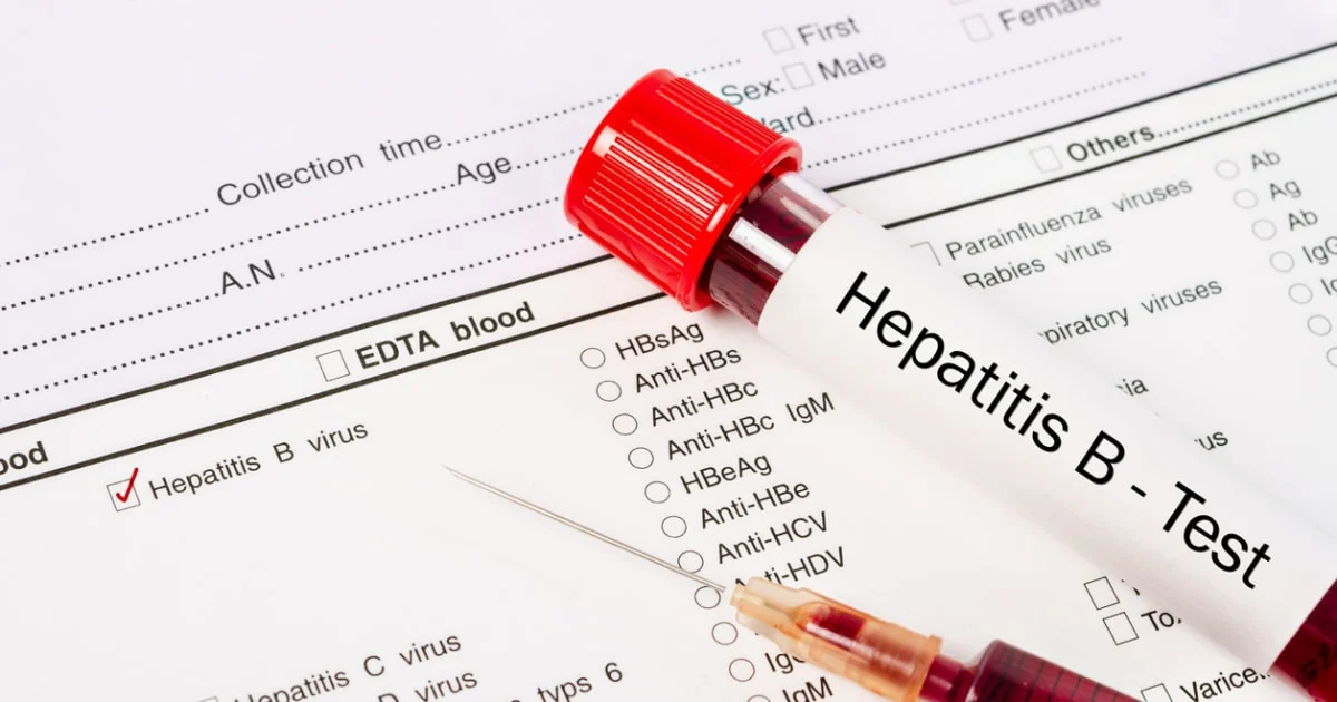 Hepatitis B Surface Antigen (HBsAg Blood Test): Purpose, Procedure, and ...